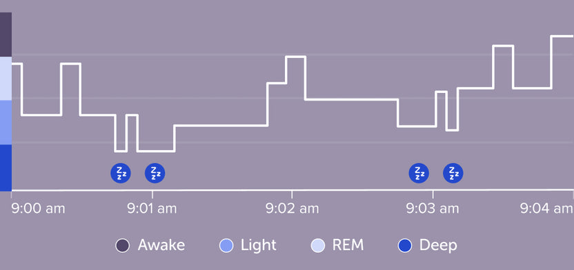 Muse® EEG Mental Fitness & Sleep Headband